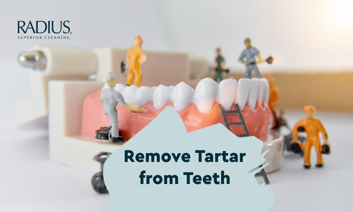 How to Remove Tartar from Teeth